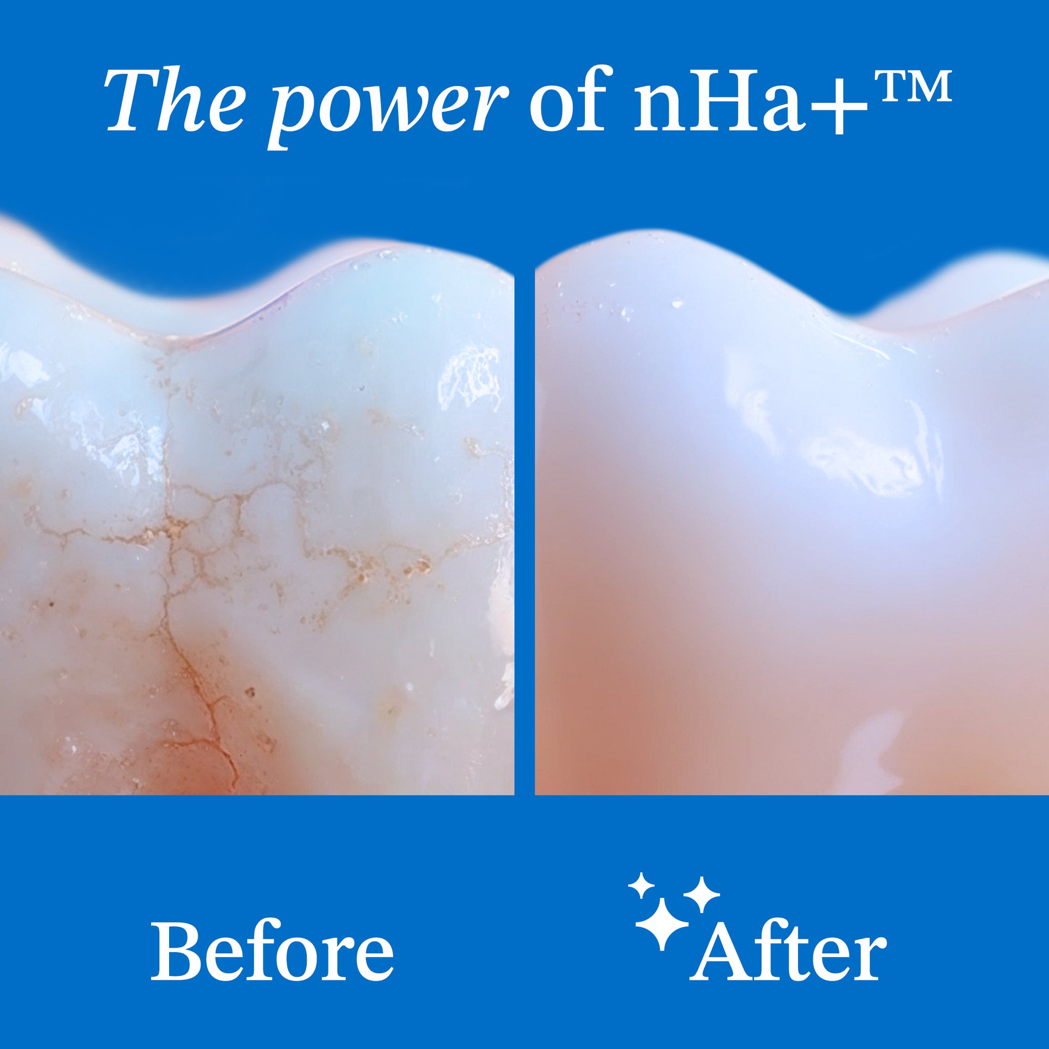 10% Nano Hydroxyapatite Toothpaste by Mouthology